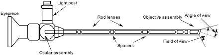 Brief Introduction of rigid endoscopes